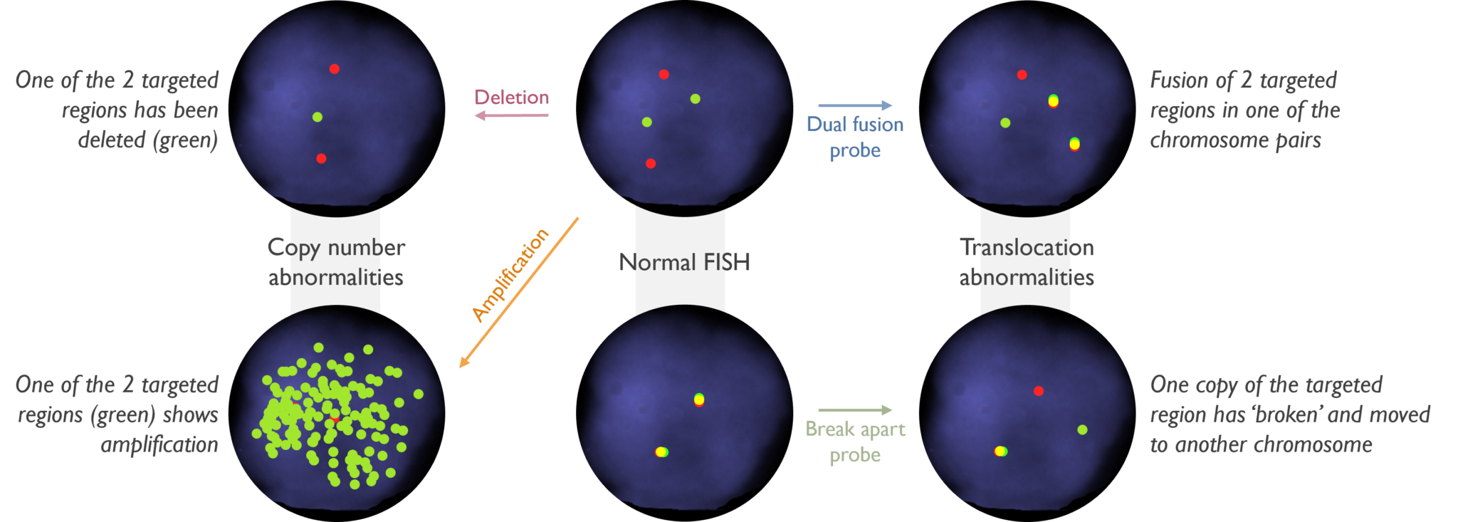 Laboratory Cancer Services - Newcastle Hospitals Laboratories