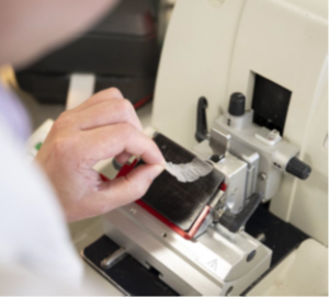 For Patients - Newcastle Hospitals Laboratories